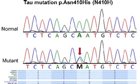 Novel MAPT P N410H Mutation In Exon 13 Chromatogram Of Mutant And Download Scientific Diagram