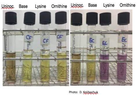 Lysine Decarboxylase Test