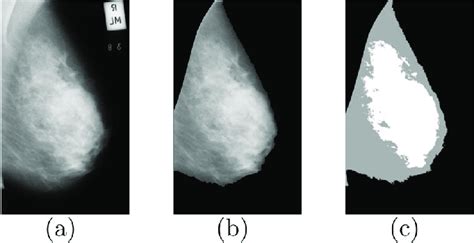 Preprocessing Steps For Feature Extraction A Original Mammogram B Download Scientific