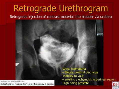 Pelvis Acetabulum Anatomy Imaging Classification Pptx Pelvis Acetabulum Anatomy Imaging Classification Pptx