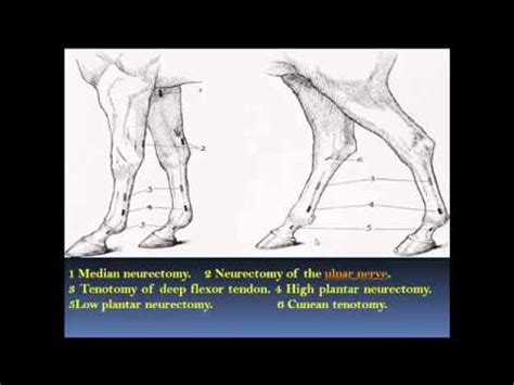 Cunean Tendon Youtube