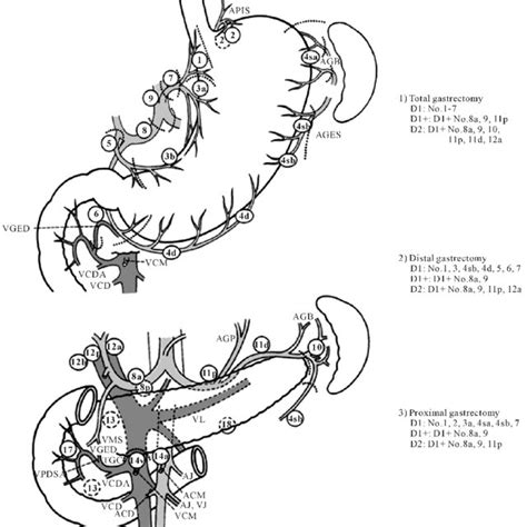 The Lymph Node Number According To The Japanese Classification Of