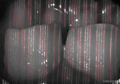 口内牙齿扫描，线激光中心提取，改进的steger算法steger激光线中心提取算法 Csdn博客