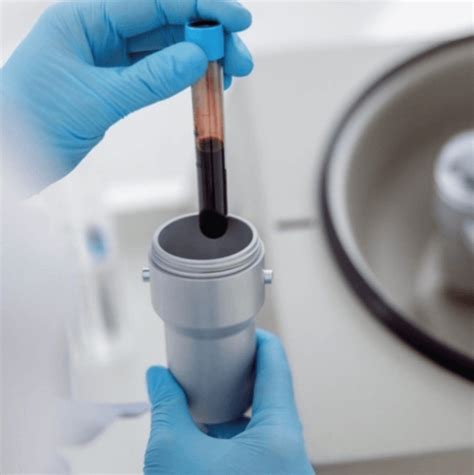 Prp Skin Quality Devonshire Dermatology London