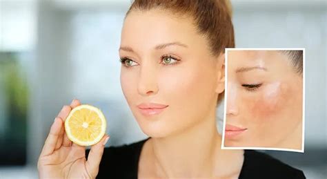 Пигментные пятна на теле причины появления и как убрать