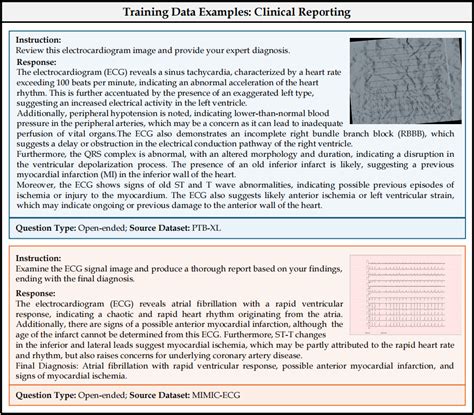 Pulse Ecgecginstruct · Datasets At Hugging Face