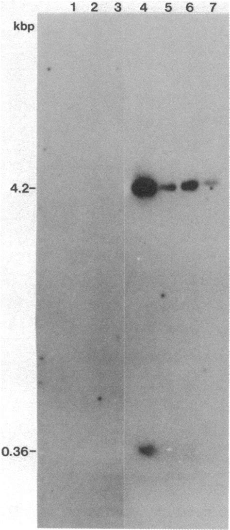 Hybridization Of 32p Labeled Cloned Ds Pstv Cdna To Restriction