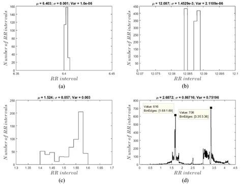 Rr Interval Histogram For Different Cardiac Rhythms A Normal
