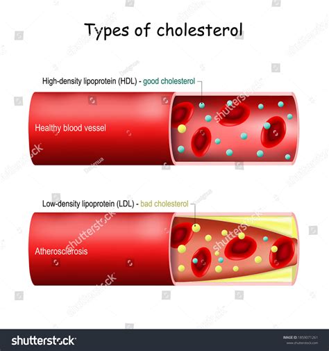 Types Cholesterol Good Hdl Bad Ldl Stock Vector Royalty Free 1859071261 Shutterstock