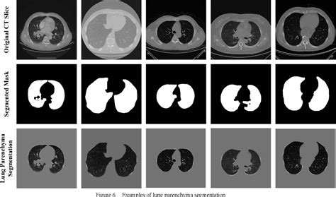 Figure 6 From Lung Nodule Detection Via 3d U Net And Contextual