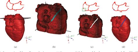 Figure 3 From An Image Based Model Of The Whole Human Heart With
