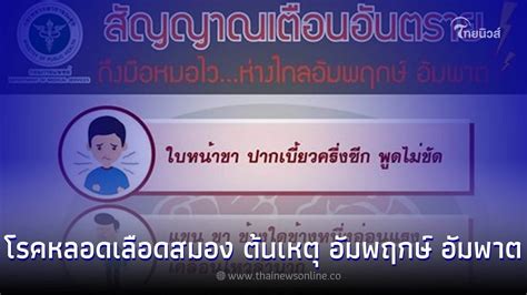 โรคหลอดเลือดสมอง ต้นเหตุ อัมพฤกษ์ อัมพาต ไทยนิวส์