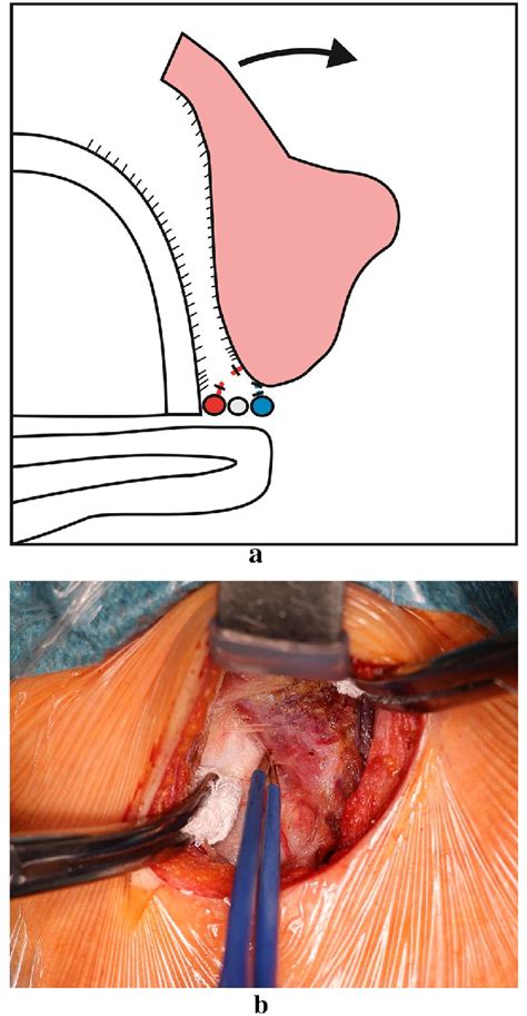 Inferior Thyroid Artery Anatomical And Developmental Aspects Of