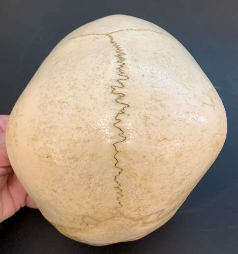 Axial Skeleton Lab Flashcards Quizlet