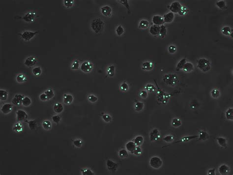 Trouble Using Cellprofiler To Count And Categorize Cells By Quantity Of Particles Consumed