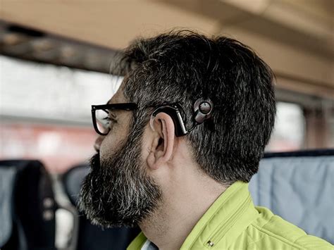 Baha Vs Cochlear Implant How To Choose