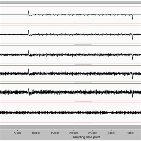 Program Diagram Of The Basic Model Of Waveform Singularity Detection