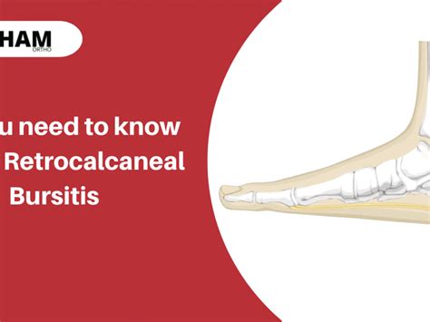 Retrocalcaneal Bursitis