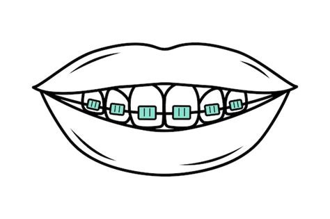 Premium Vector Human Mouth With Teeth In Braces In Doodle Style