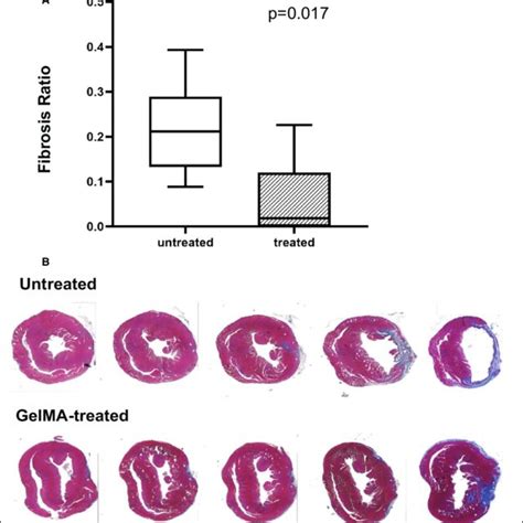 Transthoracic Echocardiography After Myocardial Infarction M Mode Download Scientific Diagram