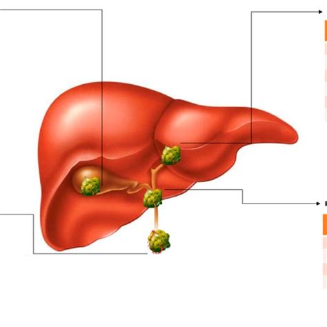 Distinct Patterns Of Molecular Mutations Recurring In Specific Anatomic