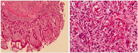 Fine Needle Aspiration Biopsy Provided The Following Pathological Download Scientific Diagram
