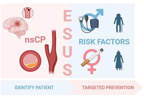 Sex Specific Risk Factors Of Nonstenotic Carotid Plaque In Embolic Stroke Of Unknown Source A