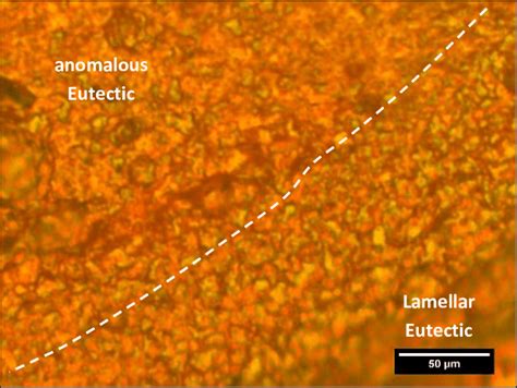 The Lamellar And Anomalous Microstructure Form Of Im Layer Left And