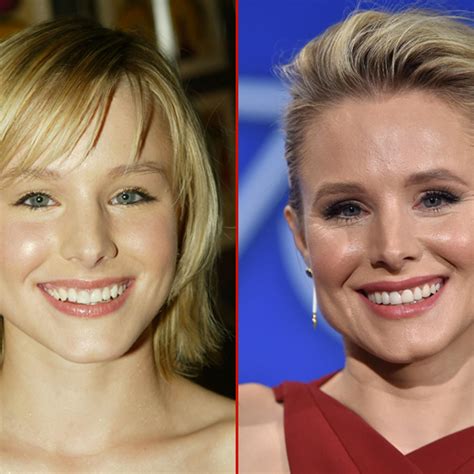 Kristen Bell Before And After