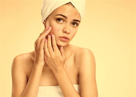Best Pimple Patches