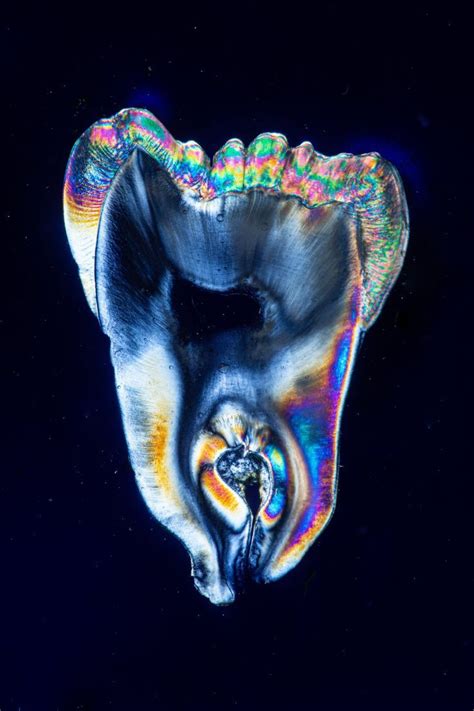 Top Dental Artofit Top Dental Artofit