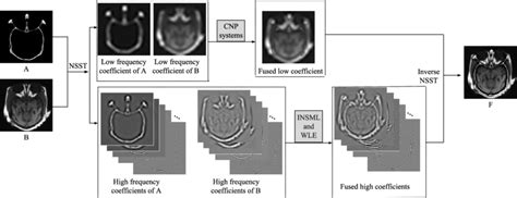 The Proposed Fusion Framework Based On Cnp Systems In Nsst Domain For Download Scientific