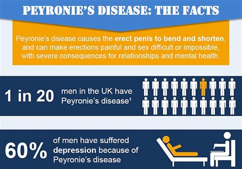 Peyronie S Disease The Condition That Affects Millions Of Men And Can