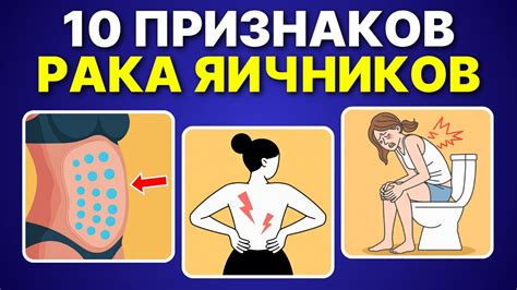 10 признаков рака яичников которые нельзя игнорировать Youtube