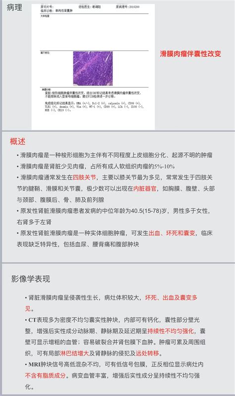 中影联盟腹部晨读病例第1093期结果 中国医学影像联盟 China Medical Imaging Association