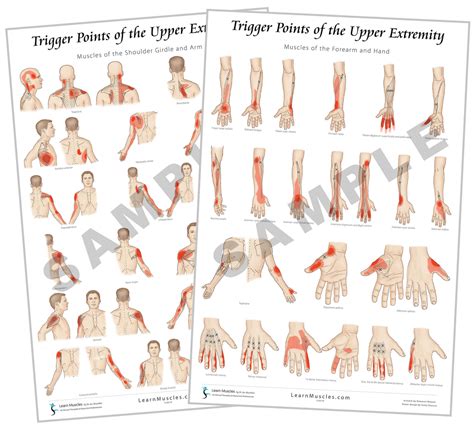 Trigger Point Upper Extremity 24 X 36 Premium Poster 2 Pack Learn Muscles
