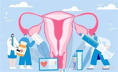 同房后出血是宫颈癌吗？ 知乎