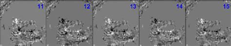 13 Perfusion Weighted Images Obtained Using Matlab Processing