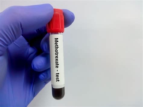 Premium Photo Blood Sample For Methotrexate Test