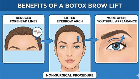 Botox Eyebrow Lift Botox Brow Lift Eyebrow Lift Botox