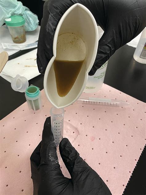 Fecal Flotation Veterian Key