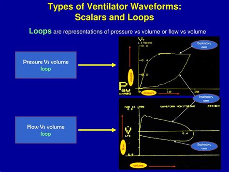 Ppt Ventilator Waveforms Basic Interpretation And Analysis Powerpoint Presentation Id 9090453