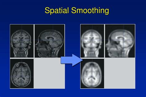Ppt Spatial Smoothing And Multiple Comparisons Correction For Dummies Powerpoint Presentation