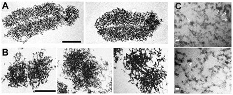 Images By Transmission Electron Microscopy Of Chromosomes Released In