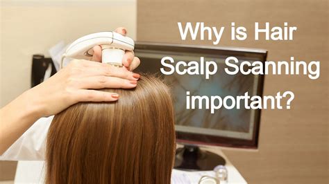 Why Hair Scalp Scanning Is Important TCM Singapore