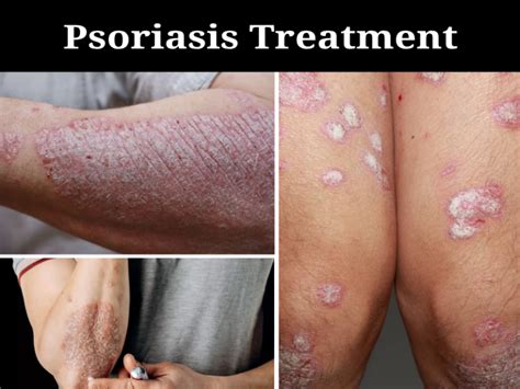 Best Skin Treatment Clinic In Mehdipatnam Club Medical Hair And Skin