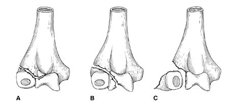 Question 212949 Qbank Orthobullets