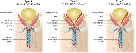 Structure Of Inferior Vesical Artery Semantic Scholar