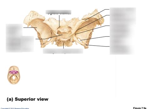 Superior Sphenoid Bone Diagram Quizlet