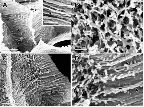 Ad Nucellar Projection Transfer Cells Of H Vulgare A In Some Cells